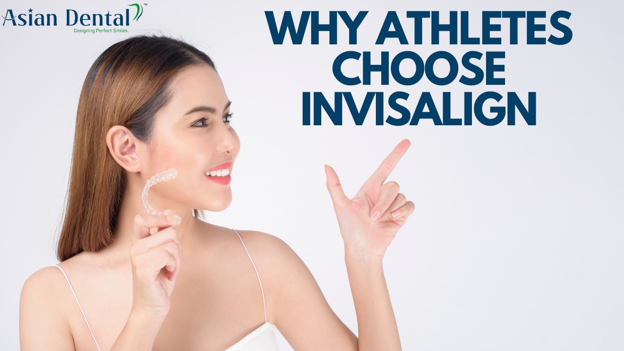 Invisalign and Sports: A Winning Combination for Athletes