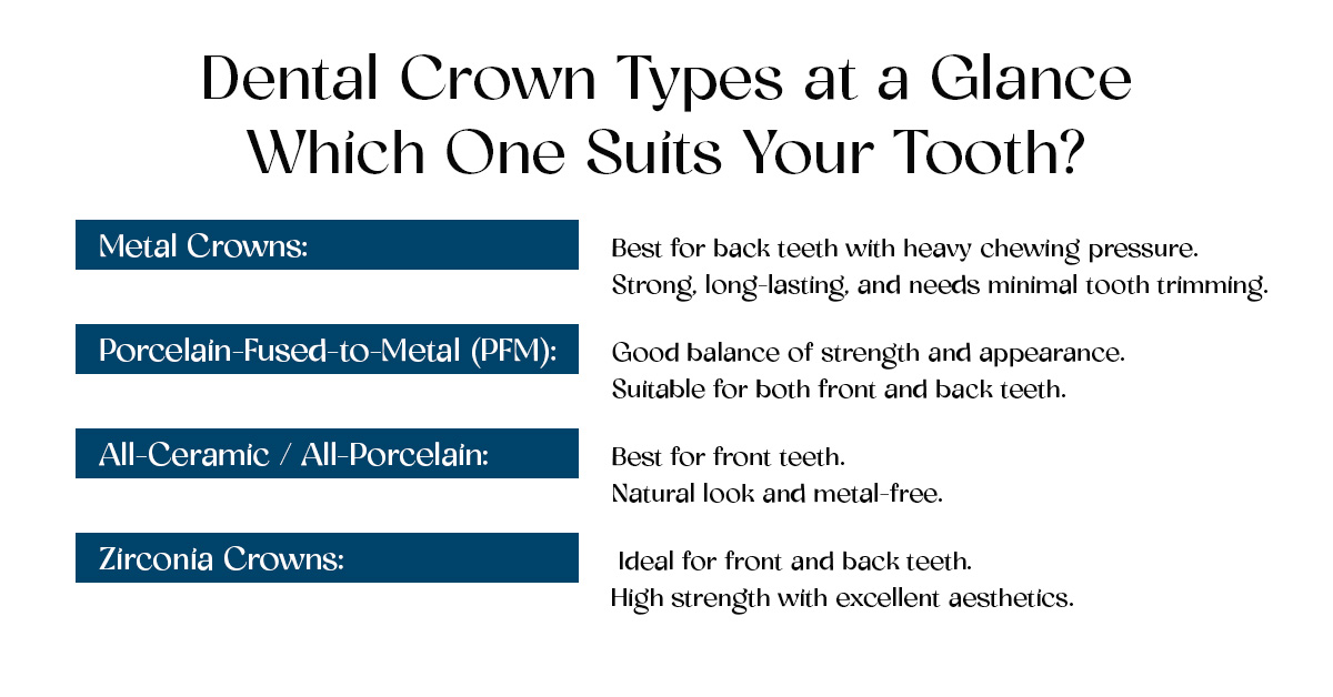 Dental Crown Types and Cost in Hyderabad