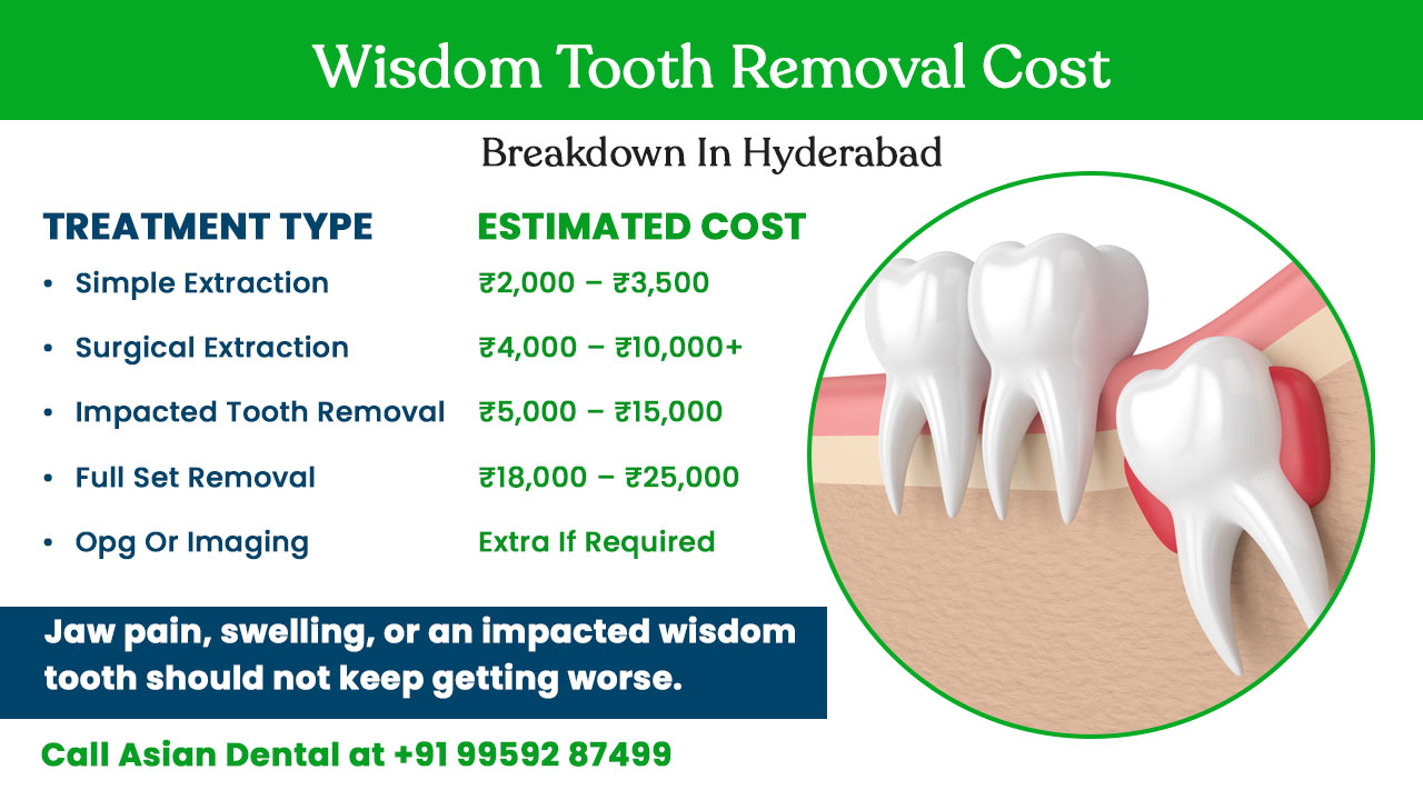 Wisdom Teeth Removal Cost in Hyderabad